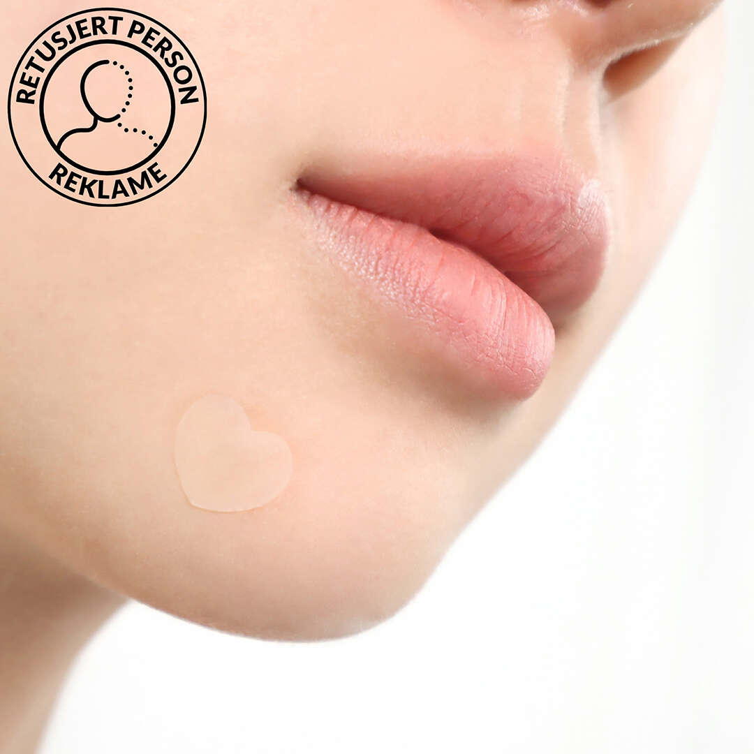 Kocostar Face Spot Mirror Patch - Fredrik & Louisa